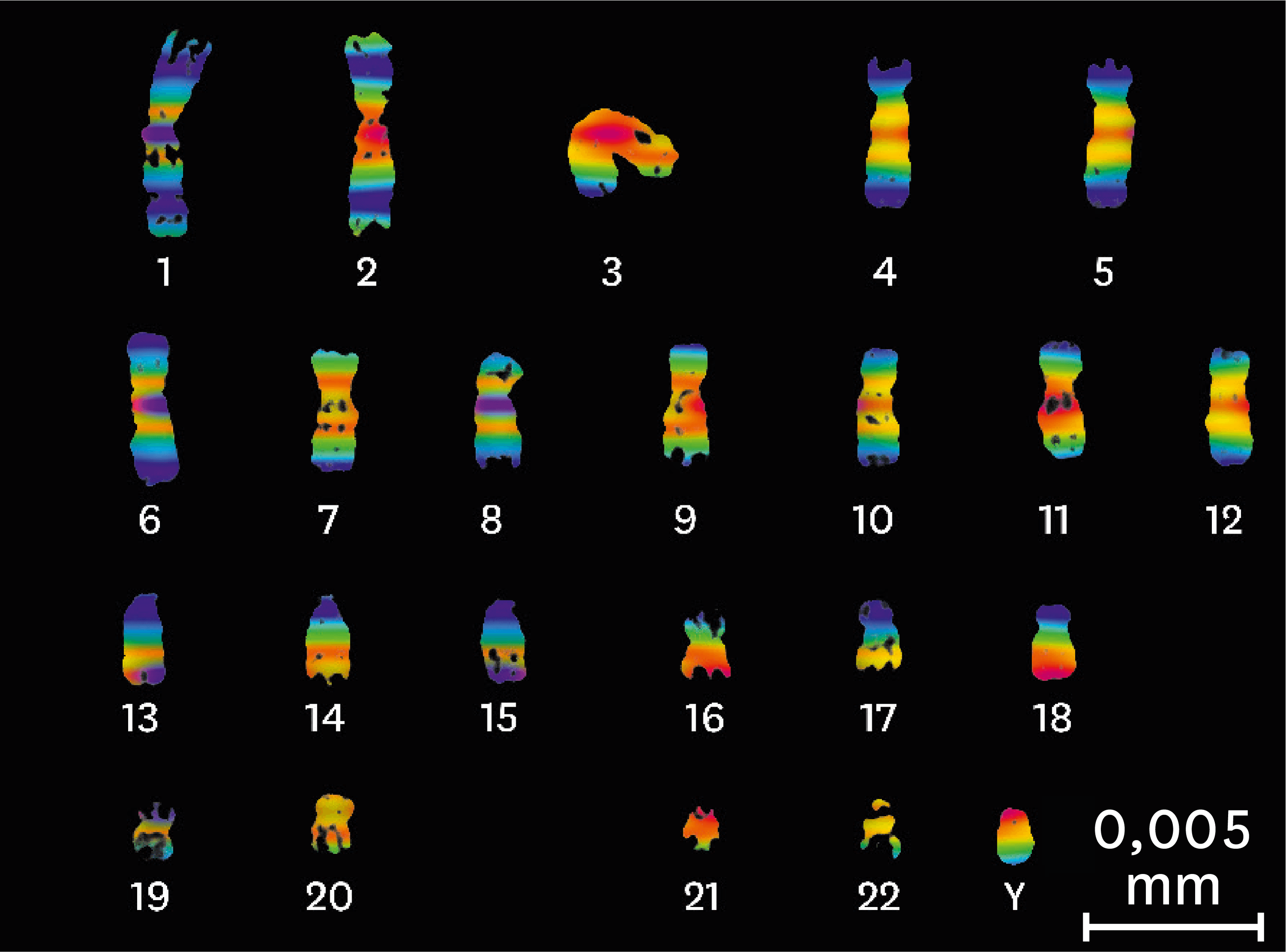 Le caryotype d'un spermatozoïde humain.