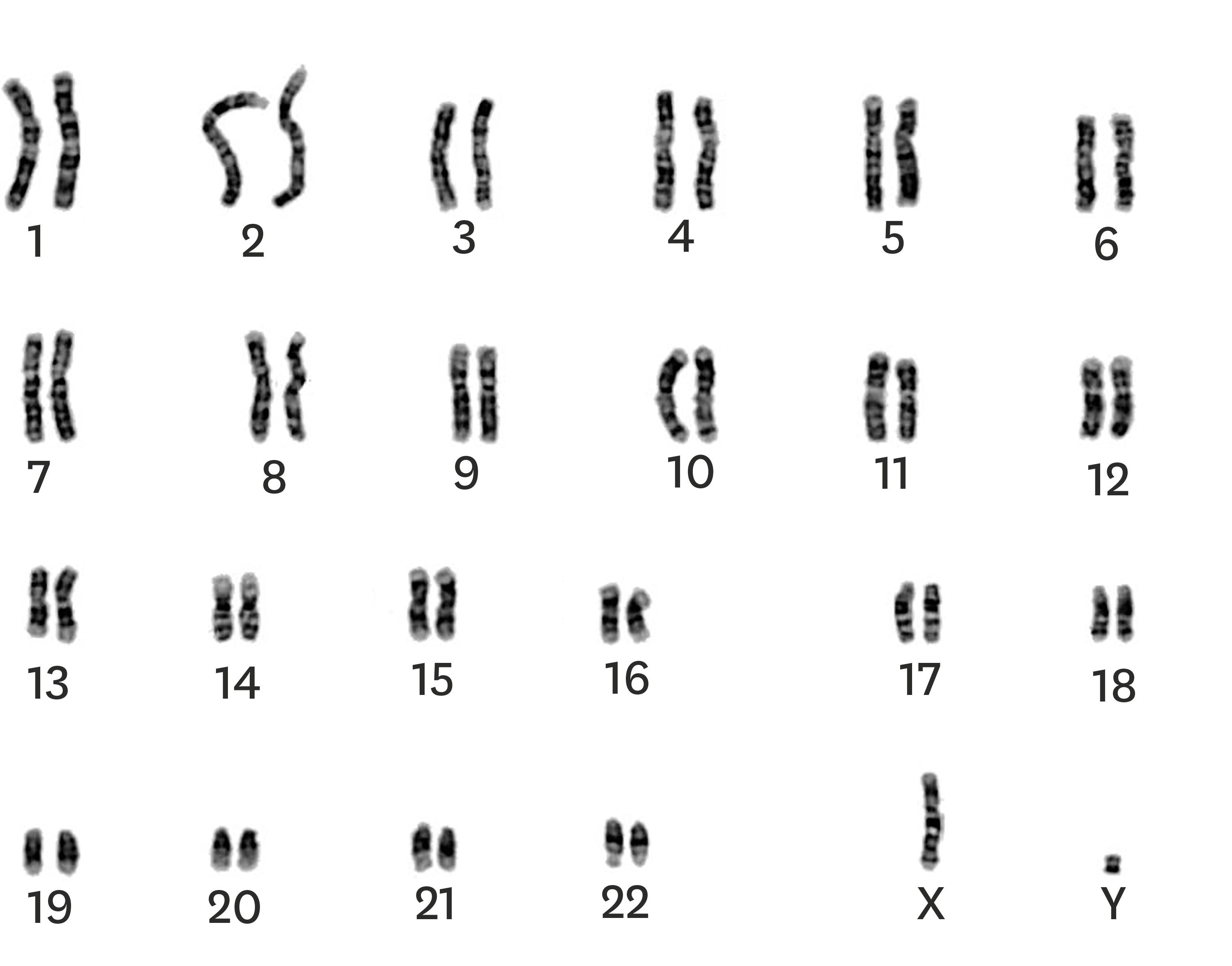 Le caryotype d'un zèbre mâle de Grévy.